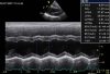 M-mode Echocardiography - Obi Veterinary Education