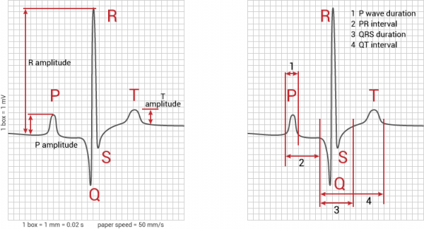 Normal ECG Parameters - Obi Veterinary Education