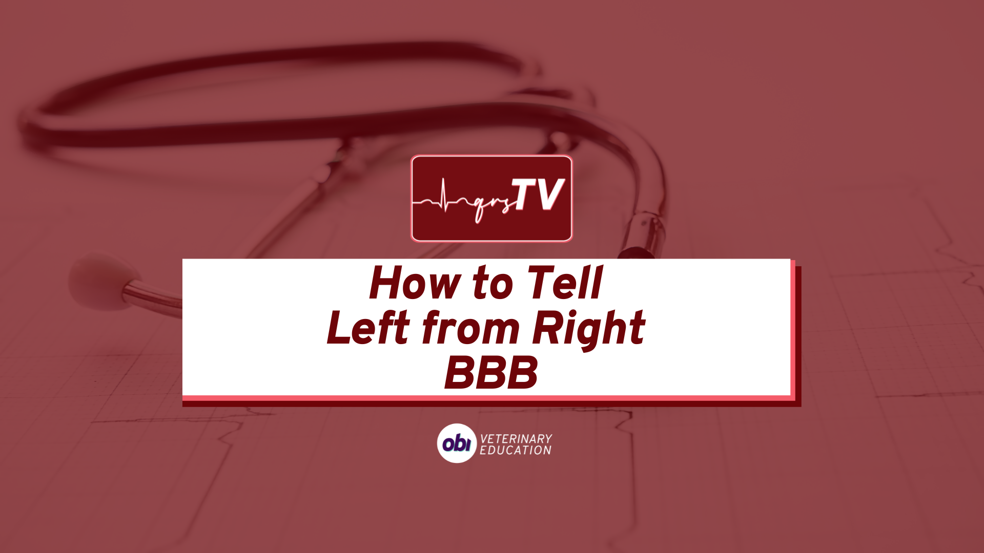 How to tell left vs right bundle branch block - qrsTV